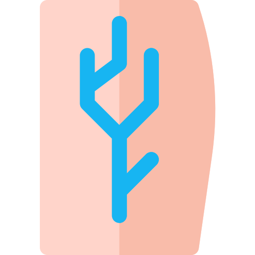 Varikocela – Urologjia